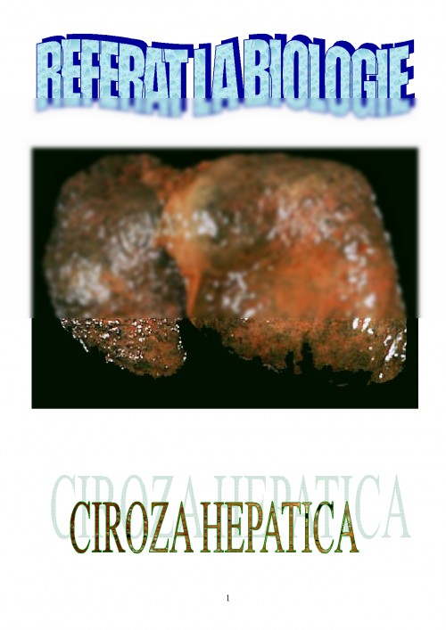 Referat: Ciroza hepatică (#183742)